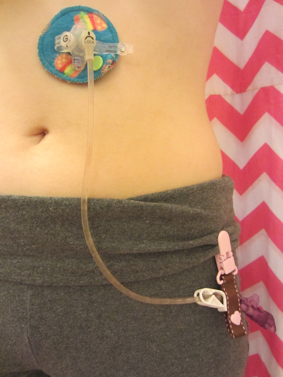 Tropical Floral Tubie Clip™ – Tickle Me Tubies